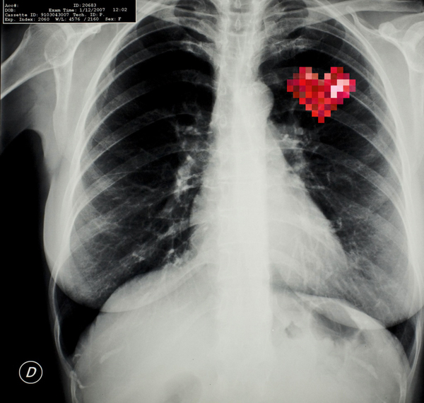 Pixel-Organs-Heart » Design You Trust — Design Daily Since 2007
