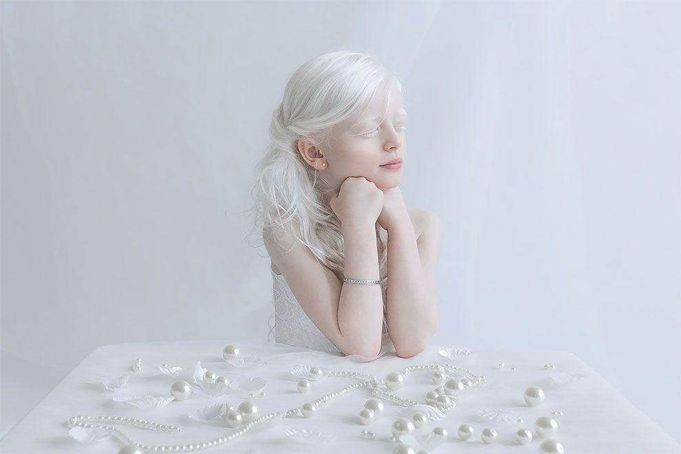 These Photos Perfectly Capture The Beauty Of People With Albinism ...