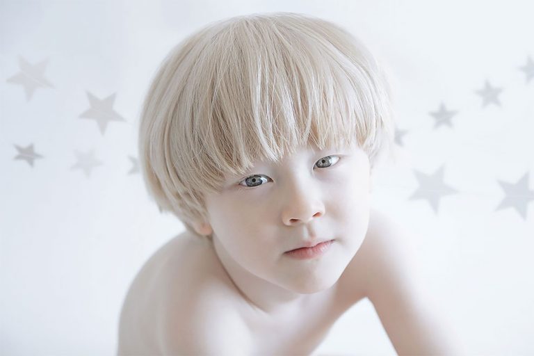 These Photos Perfectly Capture The Beauty Of People With Albinism ...