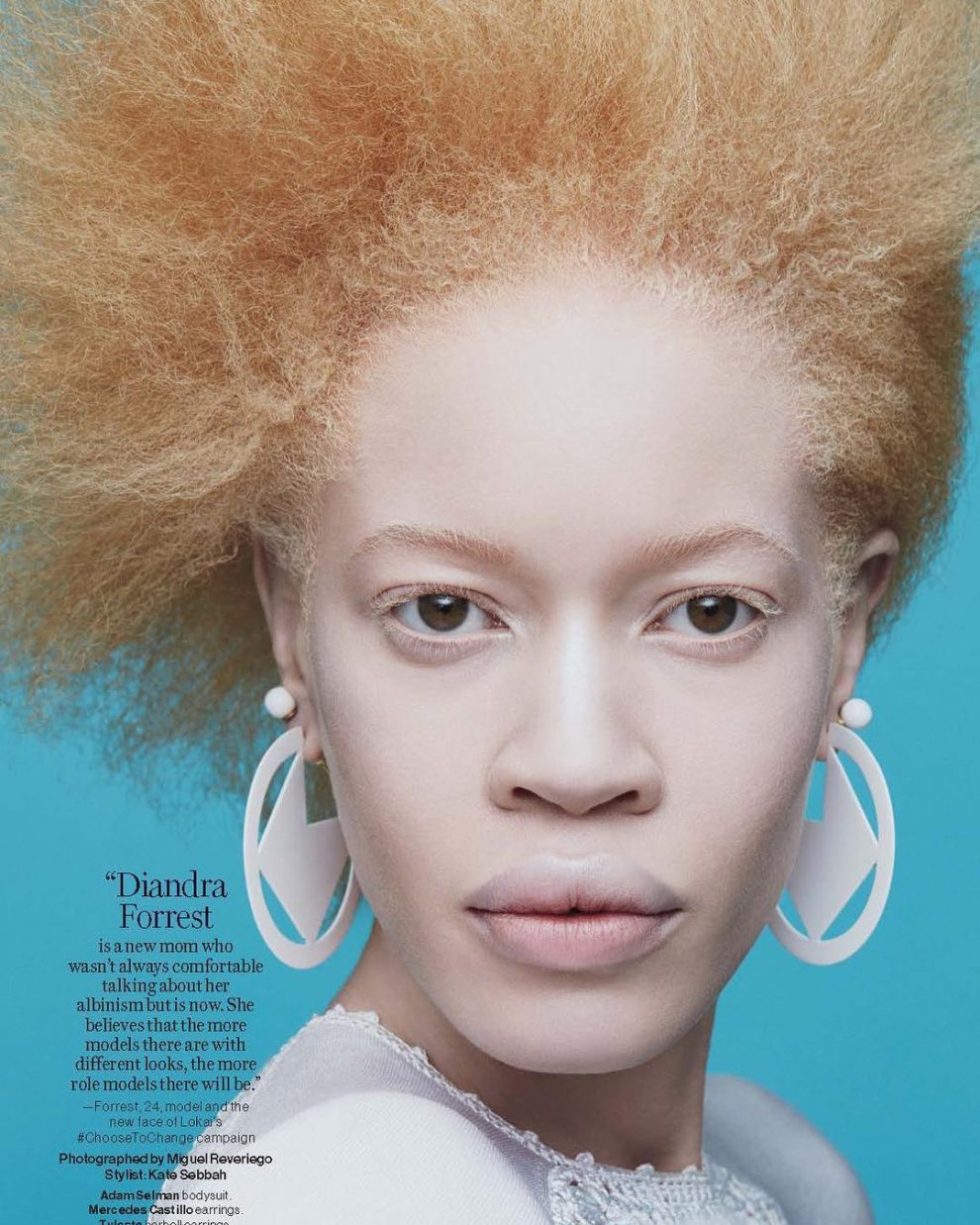 Meet Diandra Forrest, Stunning Albino African American Model » Design ...