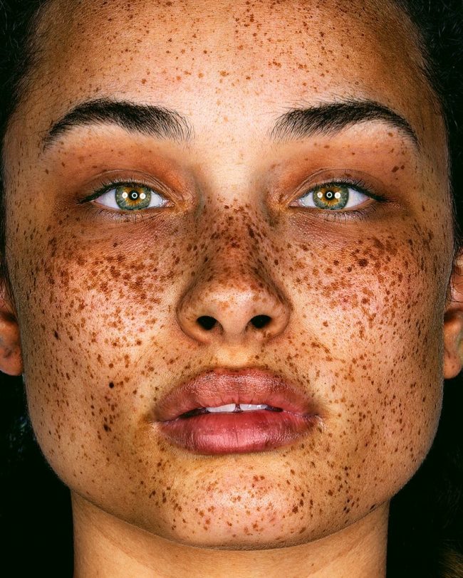 Stunning Beauty Photography Of Freckled Individuals By Brock Elbank ...