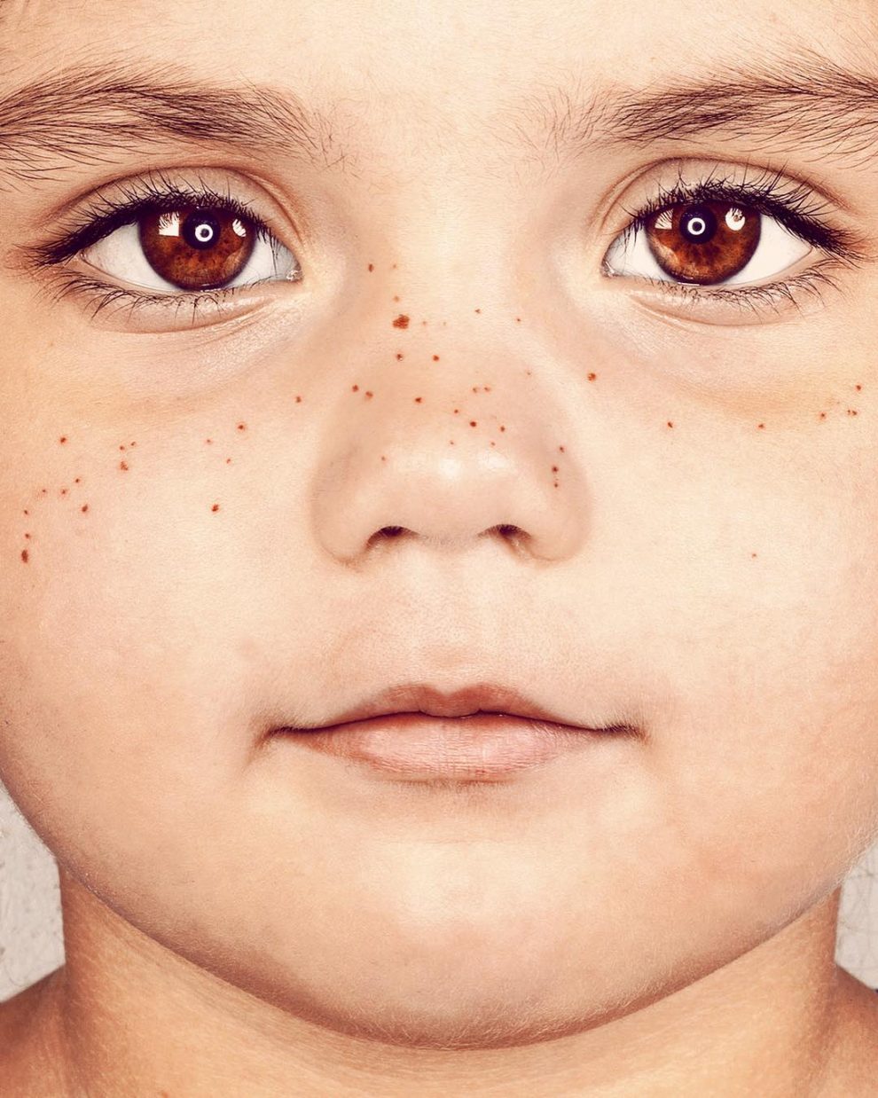 Stunning Beauty Photography Of Freckled Individuals By Brock Elbank ...