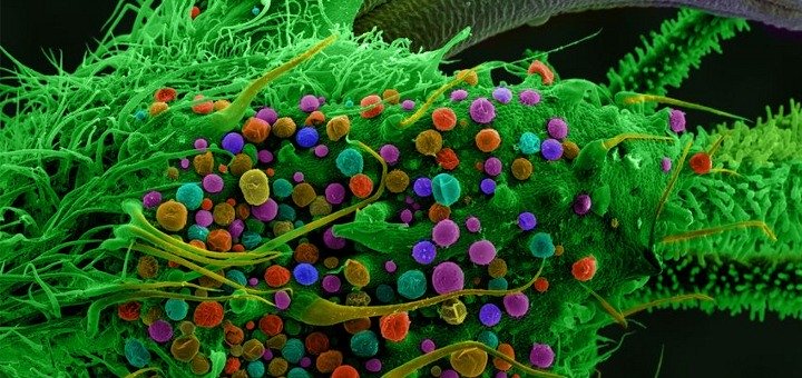 Here’s What Marijuana Looks Like Under The Microscope » Design You ...
