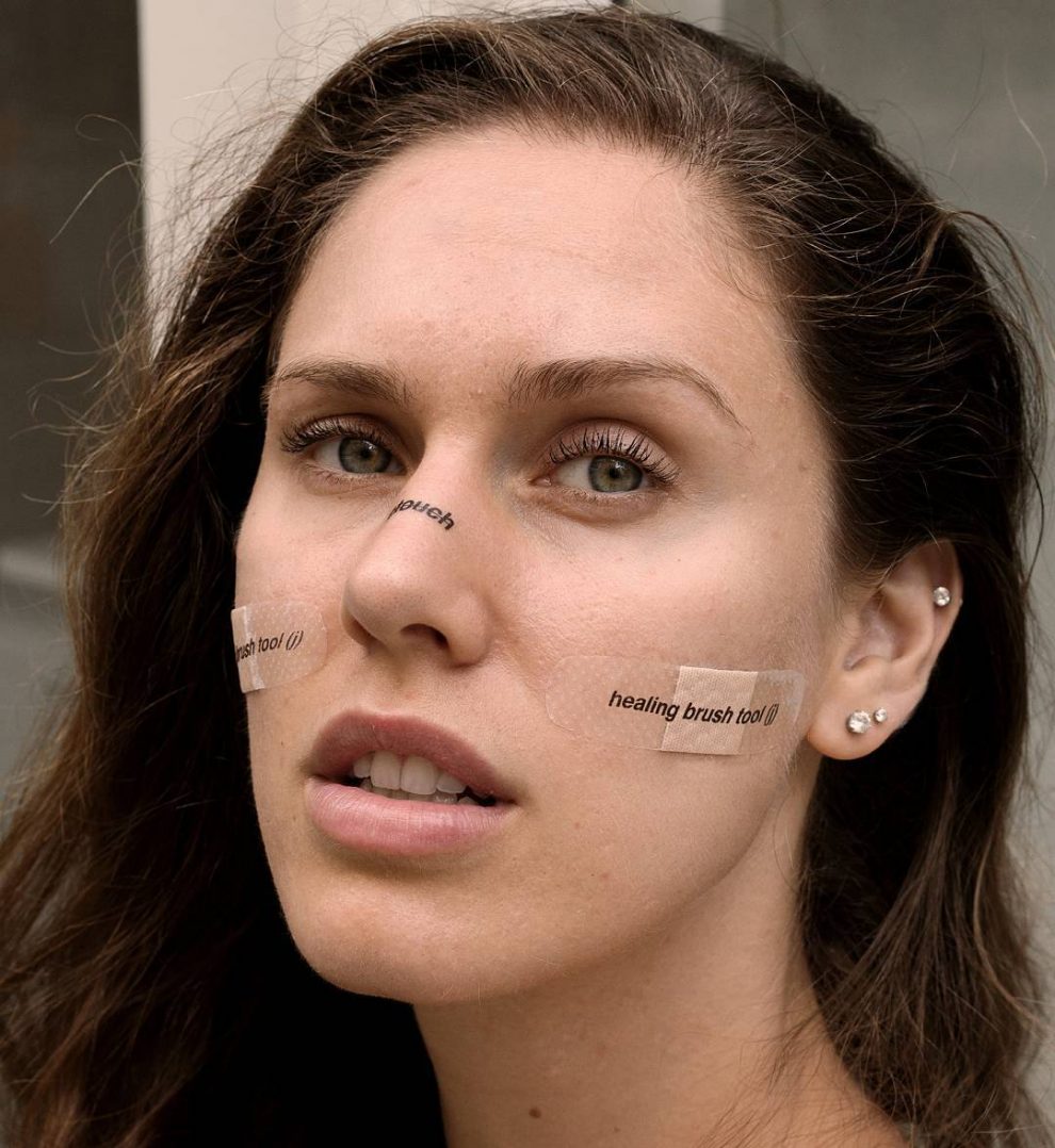 This Photographer Takes Beautiful Portraits Of People With Acne ...