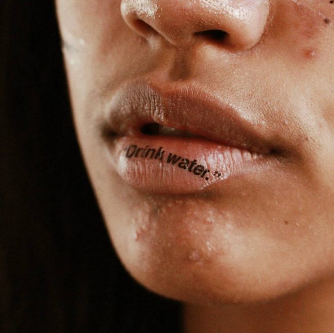 This Photographer Takes Beautiful Portraits Of People With Acne ...