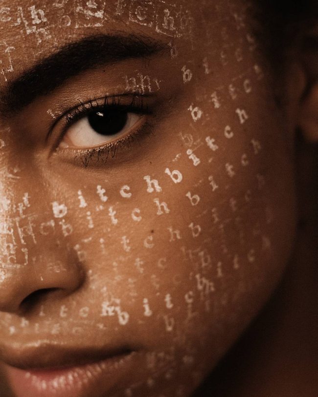 This Photographer Takes Beautiful Portraits Of People With Acne ...