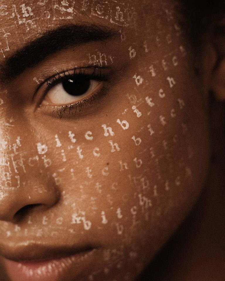 This Photographer Takes Beautiful Portraits Of People With Acne ...