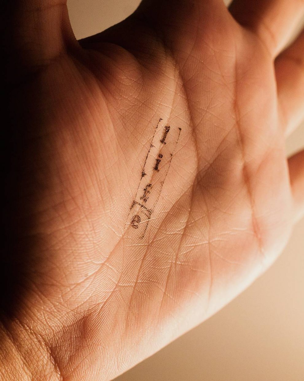 This Photographer Takes Beautiful Portraits Of People With Acne ...