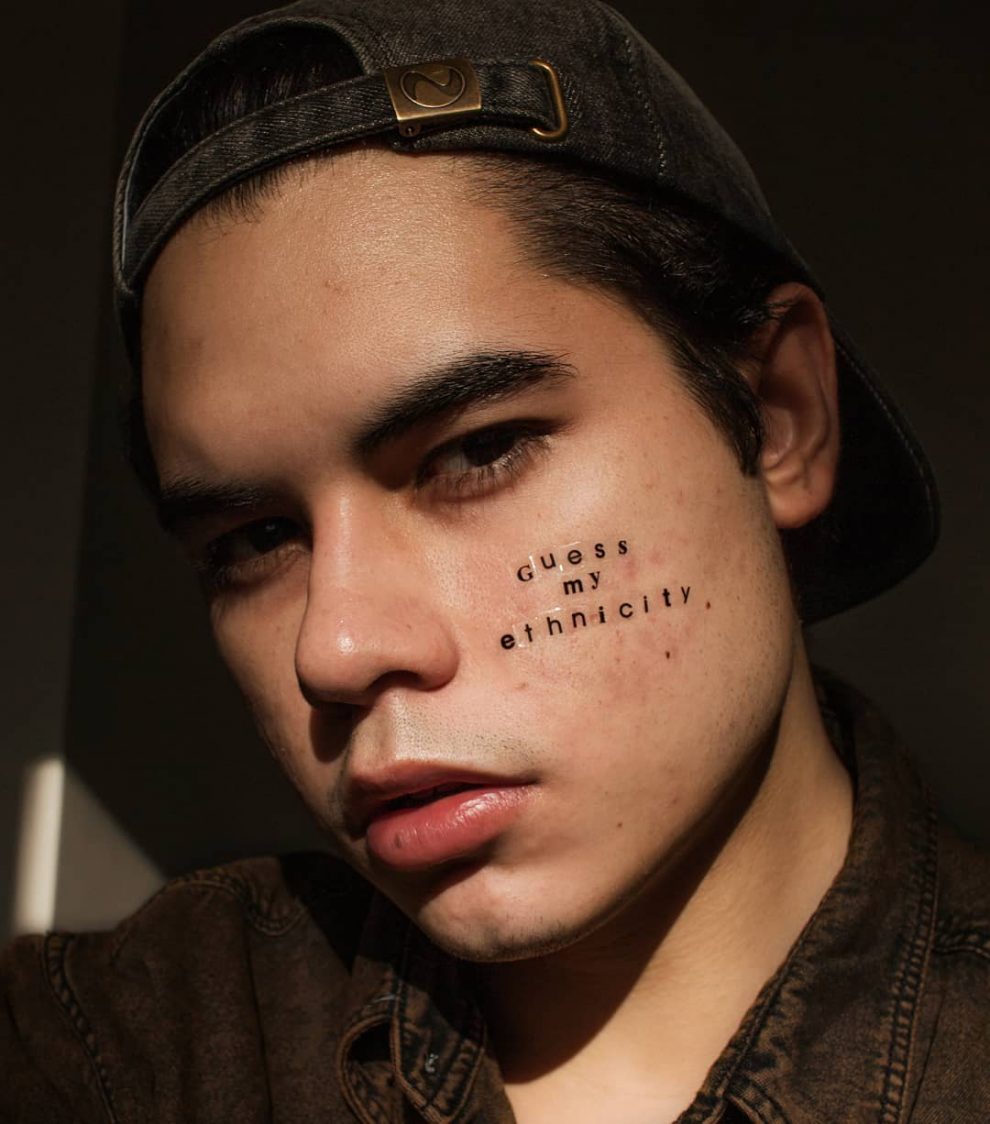 This Photographer Takes Beautiful Portraits Of People With Acne ...