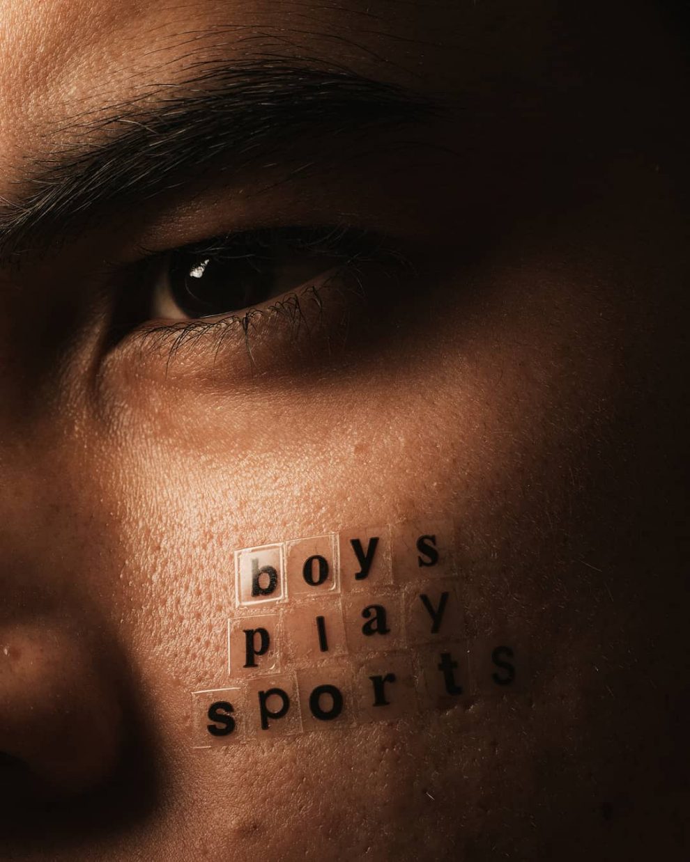 This Photographer Takes Beautiful Portraits Of People With Acne ...