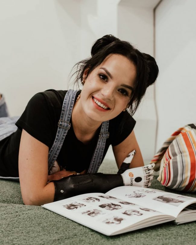 Rita – The Girl Who Happily Lives With A Bionical Hand » Design You ...