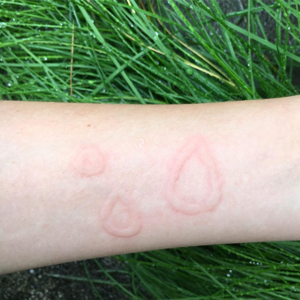 Teen Allergic to Touch Uses Her Own Body as Human Etch-a-Sketch ...