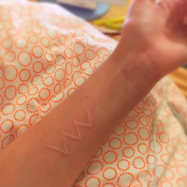 Teen Allergic to Touch Uses Her Own Body as Human Etch-a-Sketch ...