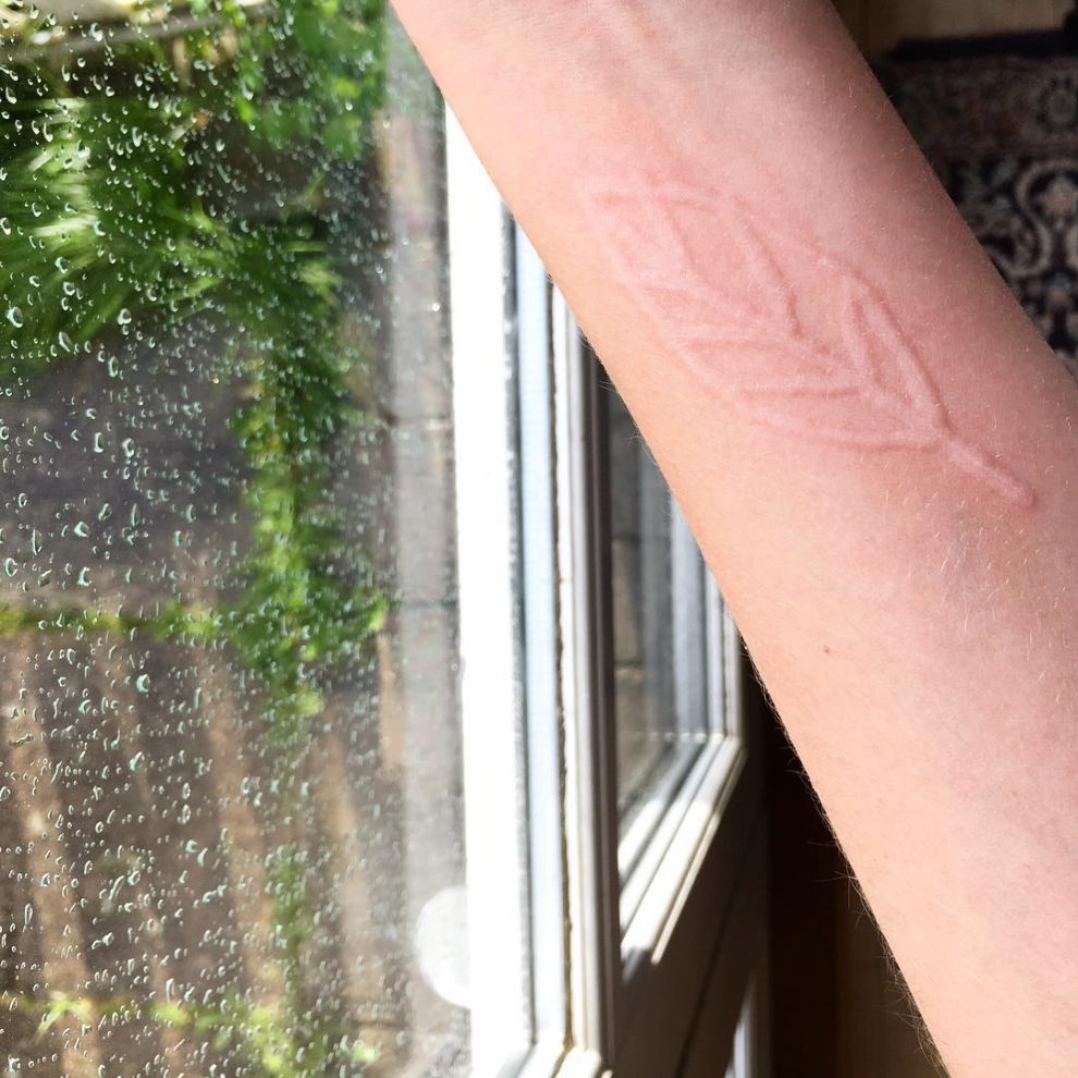 Teen Allergic to Touch Uses Her Own Body as Human Etch-a-Sketch ...