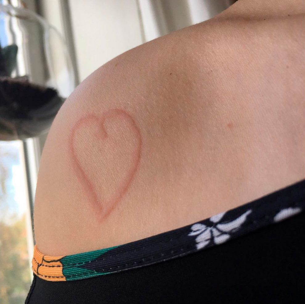 Teen Allergic to Touch Uses Her Own Body as Human Etch-a-Sketch ...