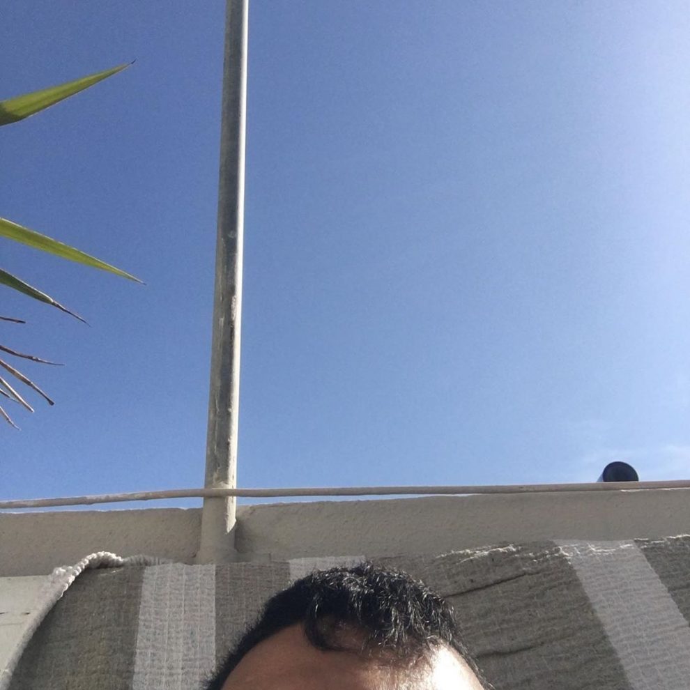 This Greek Man Living in Malta Has Been Posting Photos of His Forehead ...