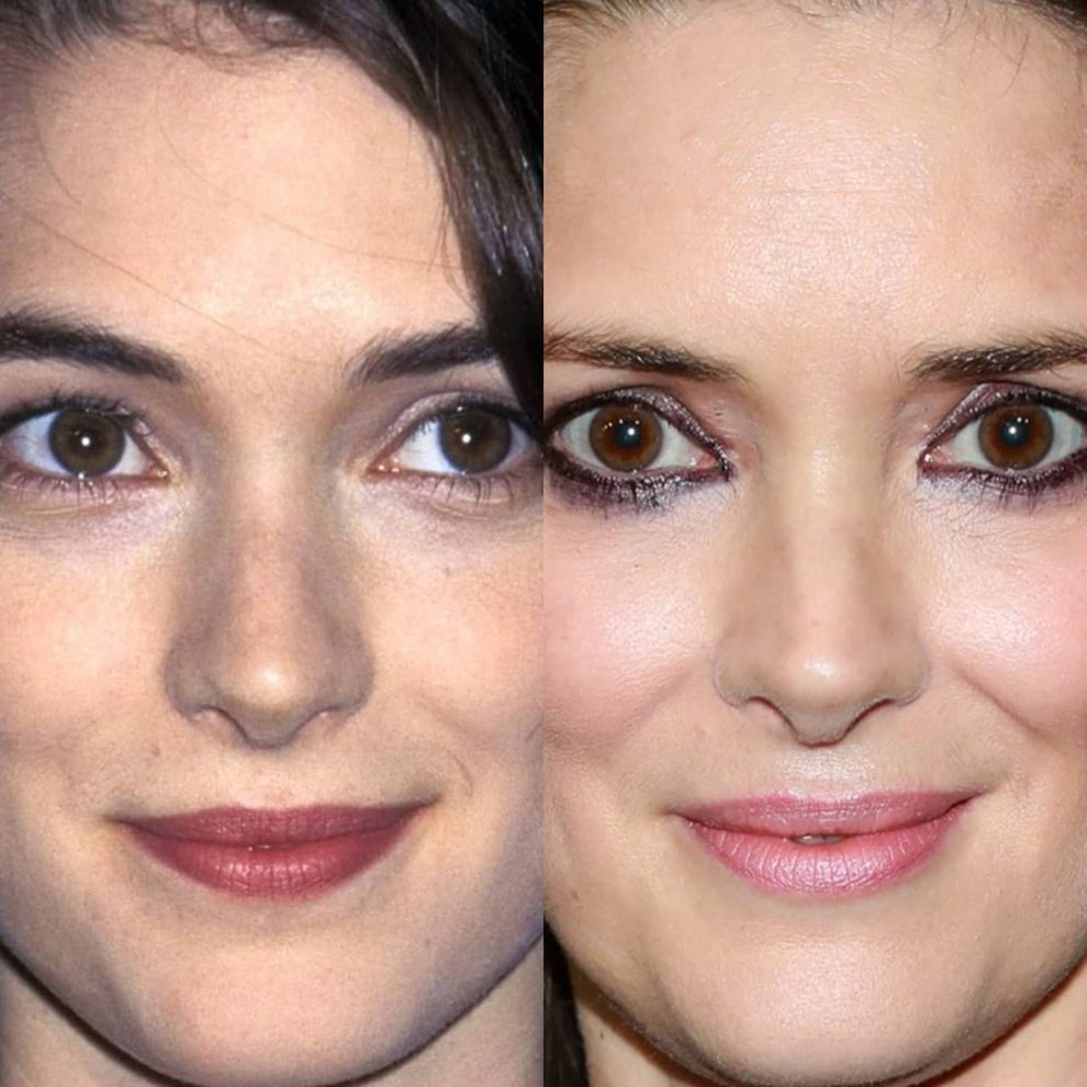 This Instagram Account Points Out How Much Celebrity Faces Have Changed ...