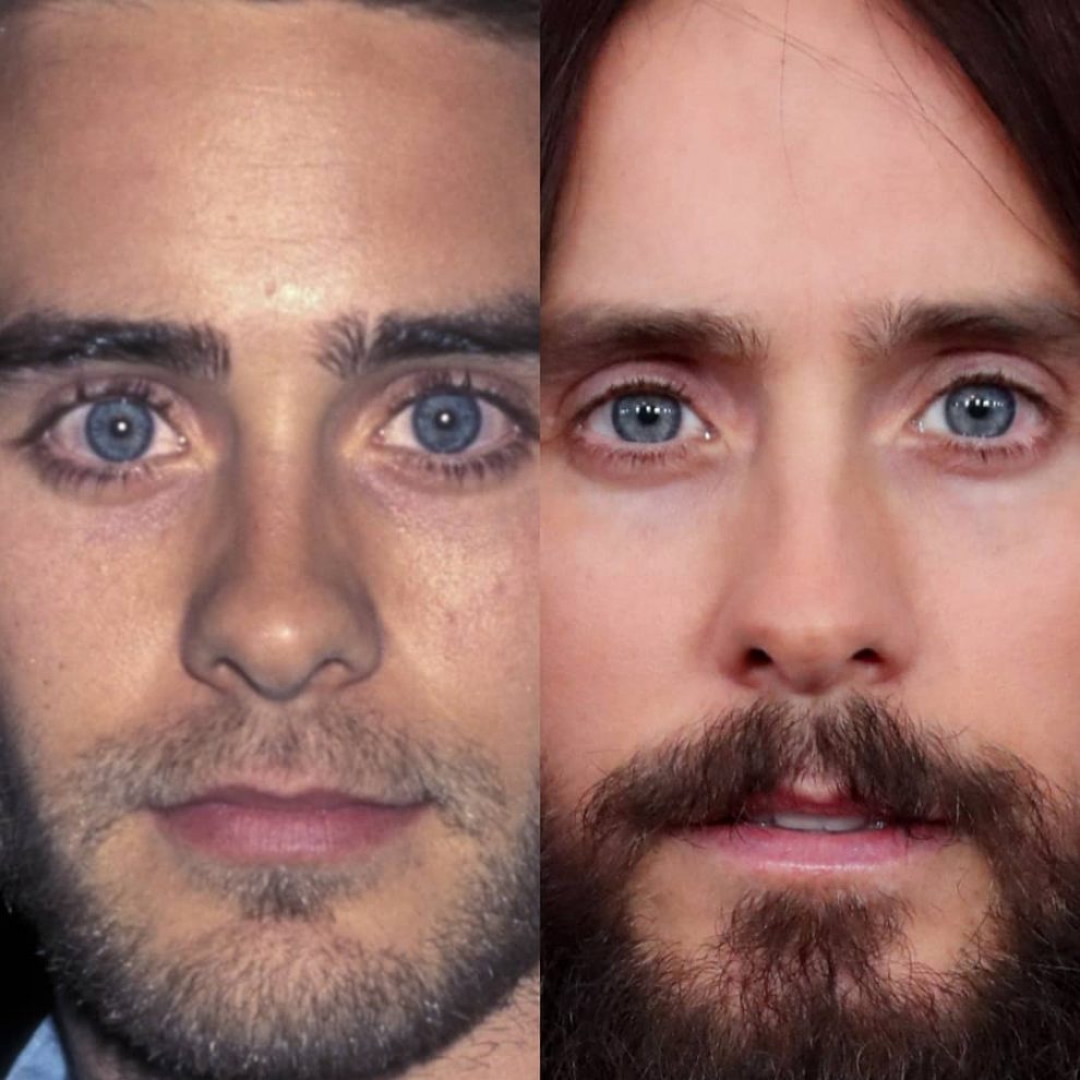 This Instagram Account Points Out How Much Celebrity Faces Have Changed ...