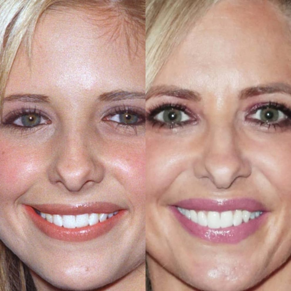 This Instagram Account Points Out How Much Celebrity Faces Have Changed ...