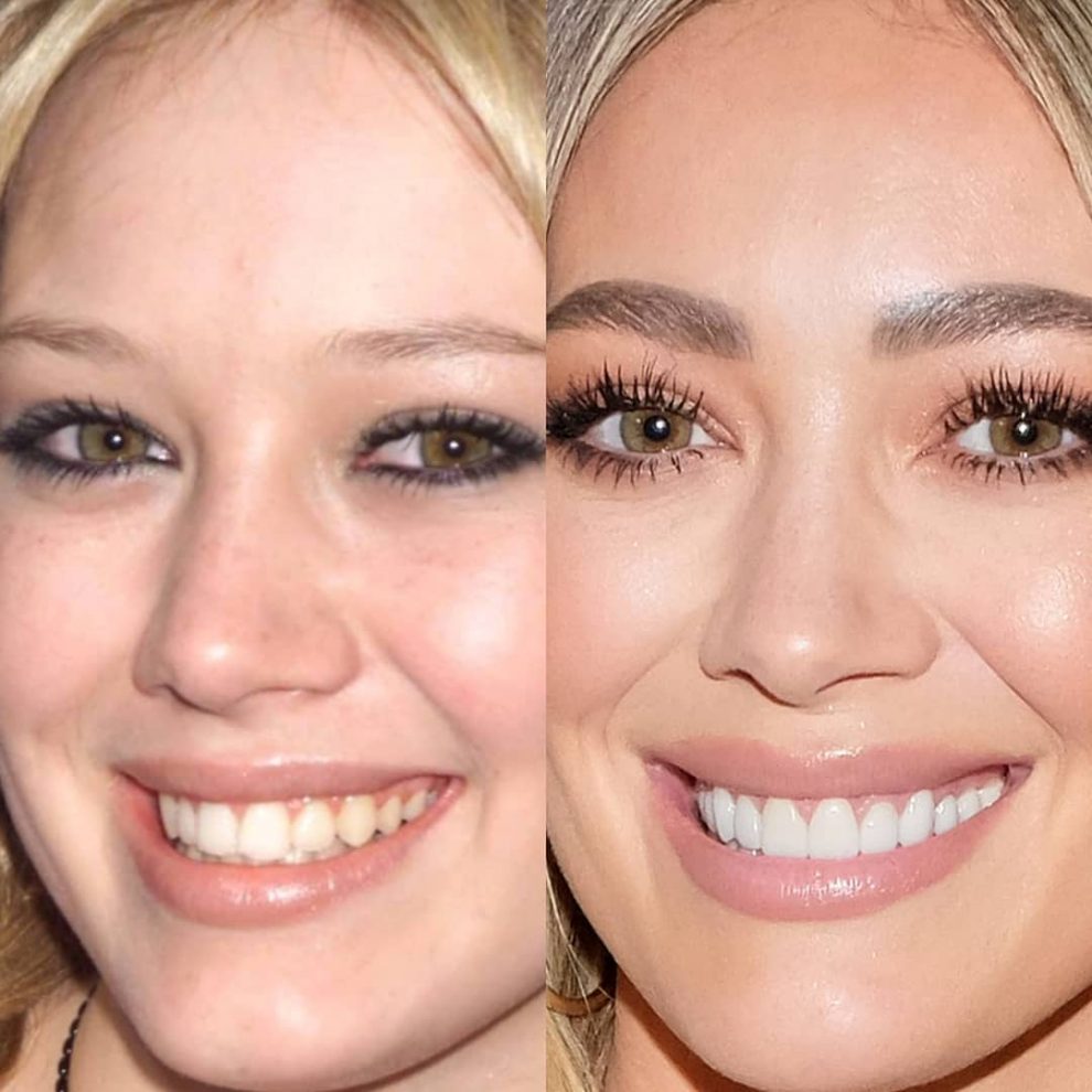 This Instagram Account Points Out How Much Celebrity Faces Have Changed ...