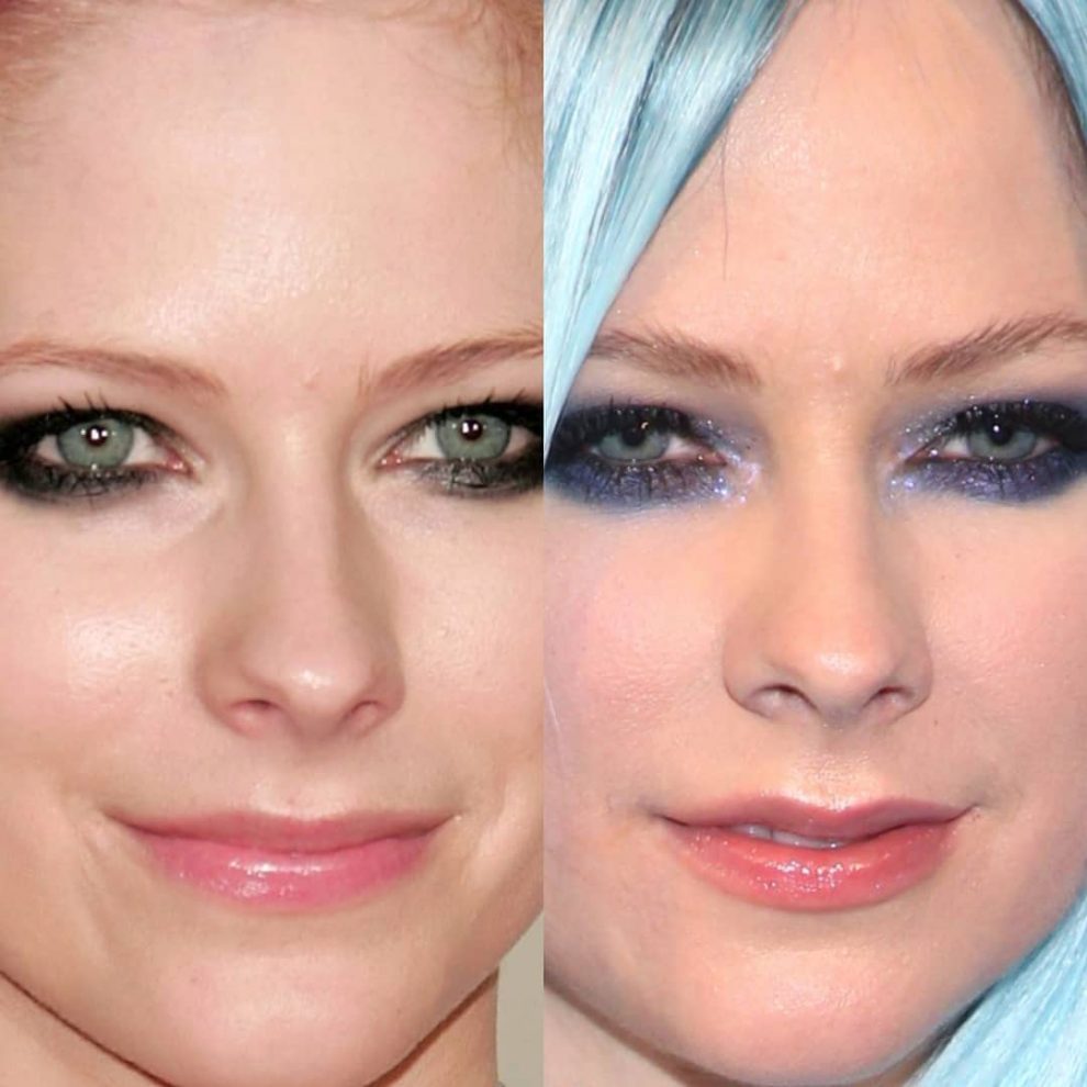 This Instagram Account Points Out How Much Celebrity Faces Have Changed ...