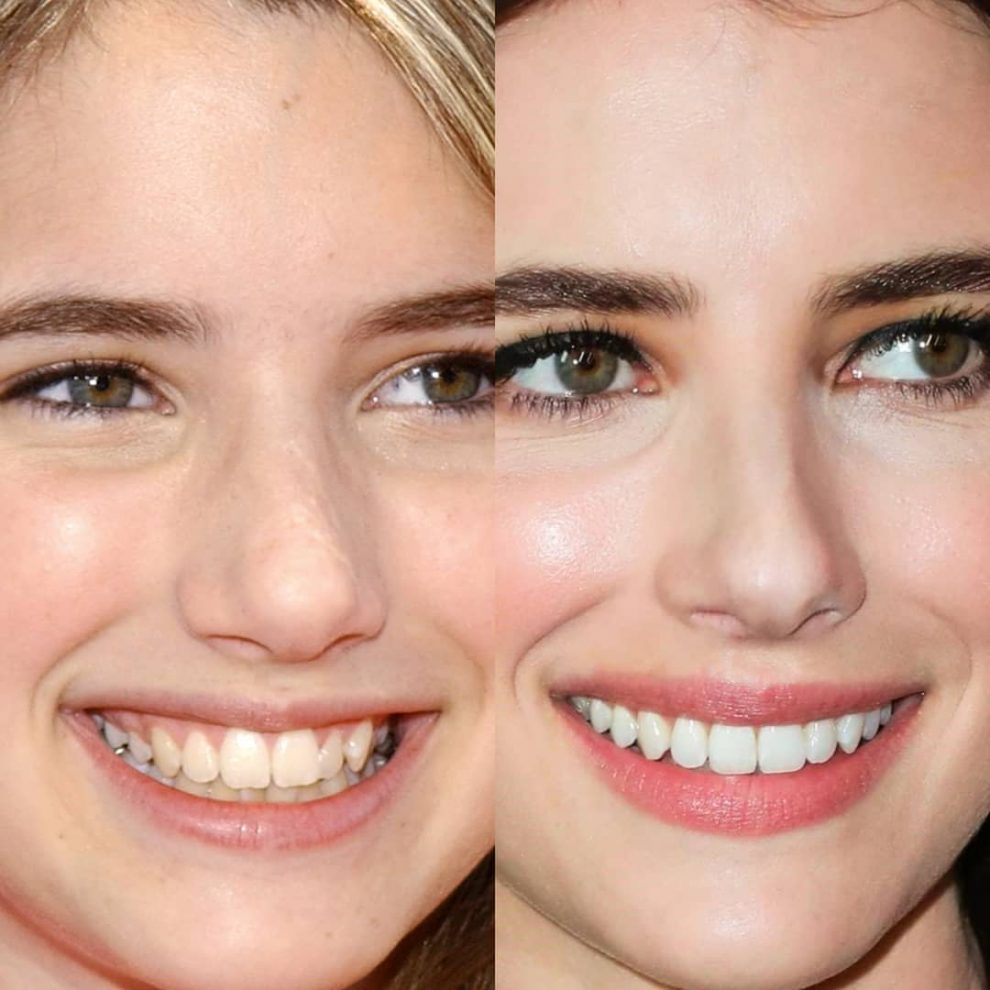 This Instagram Account Points Out How Much Celebrity Faces Have Changed ...