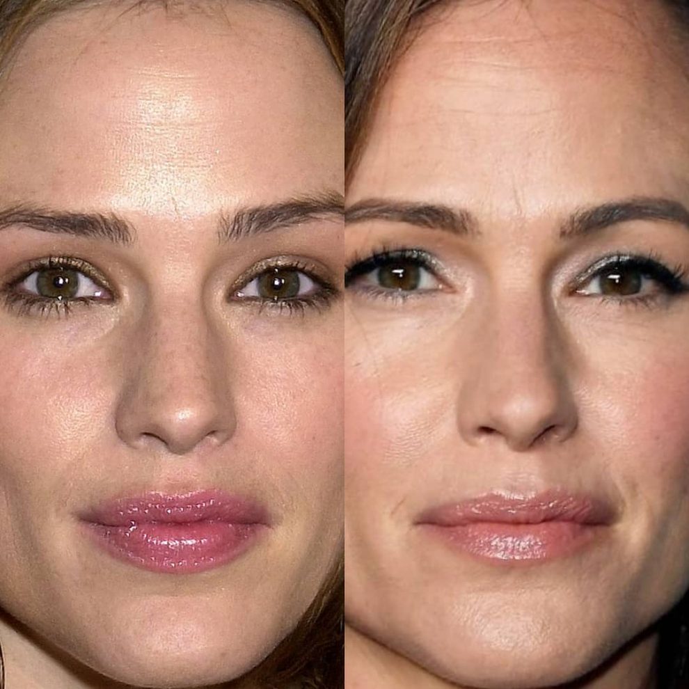 This Instagram Account Points Out How Much Celebrity Faces Have Changed ...