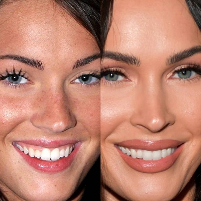 This Instagram Account Points Out How Much Celebrity Faces Have Changed ...