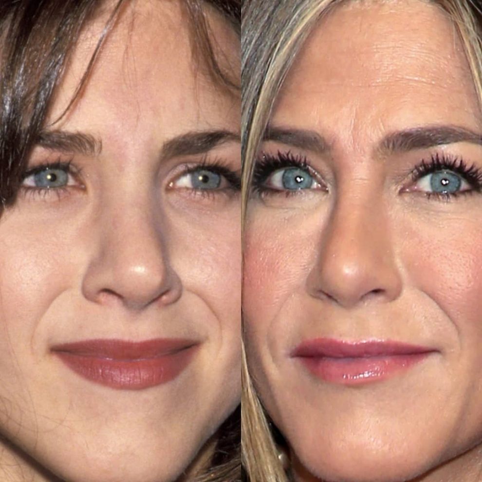 This Instagram Account Points Out How Much Celebrity Faces Have Changed ...