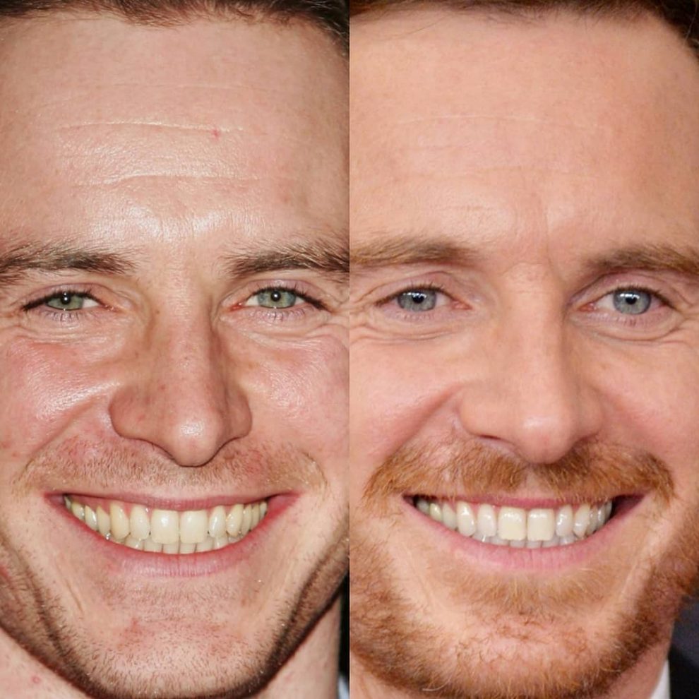 This Instagram Account Points Out How Much Celebrity Faces Have Changed ...