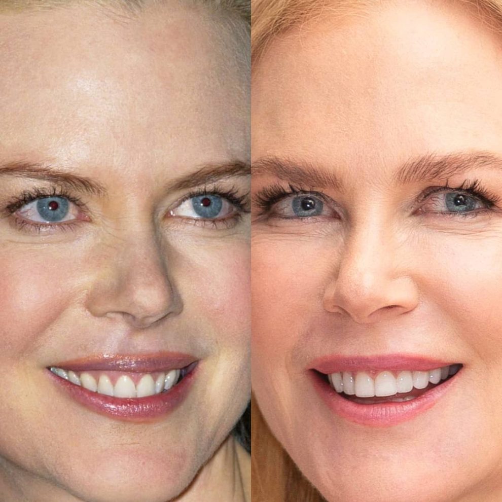 This Instagram Account Points Out How Much Celebrity Faces Have Changed ...