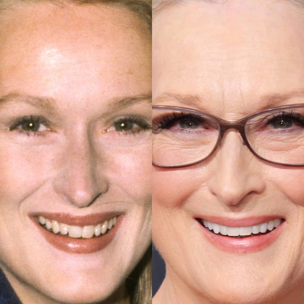 This Instagram Account Points Out How Much Celebrity Faces Have Changed ...