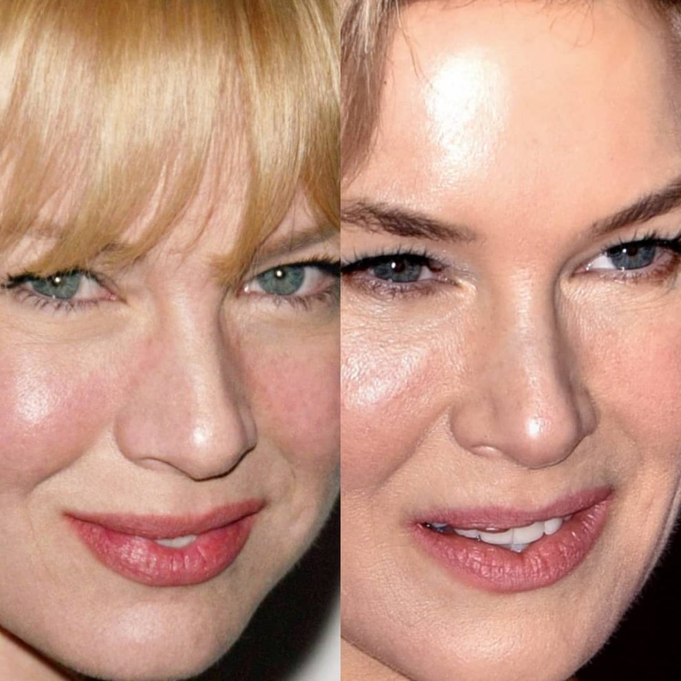 This Instagram Account Points Out How Much Celebrity Faces Have Changed ...