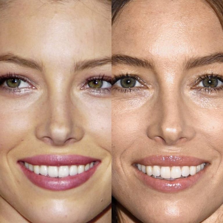 This Instagram Account Points Out How Much Celebrity Faces Have Changed ...