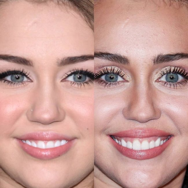 This Instagram Account Points Out How Much Celebrity Faces Have Changed ...