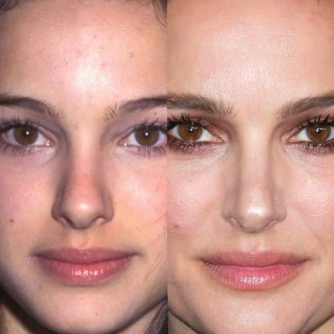 This Instagram Account Points Out How Much Celebrity Faces Have Changed ...