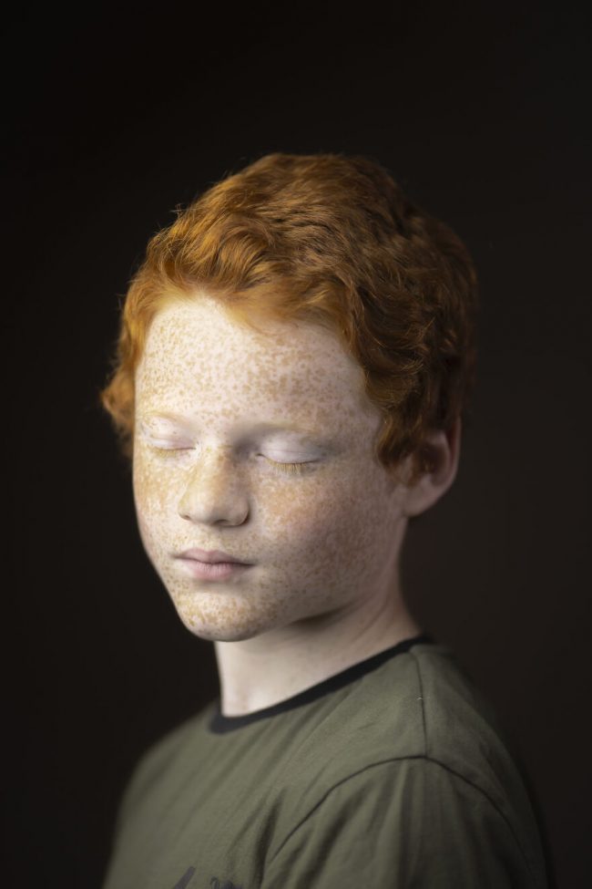 Scottish Photographer Has Been Photographing Ginger People Around The ...