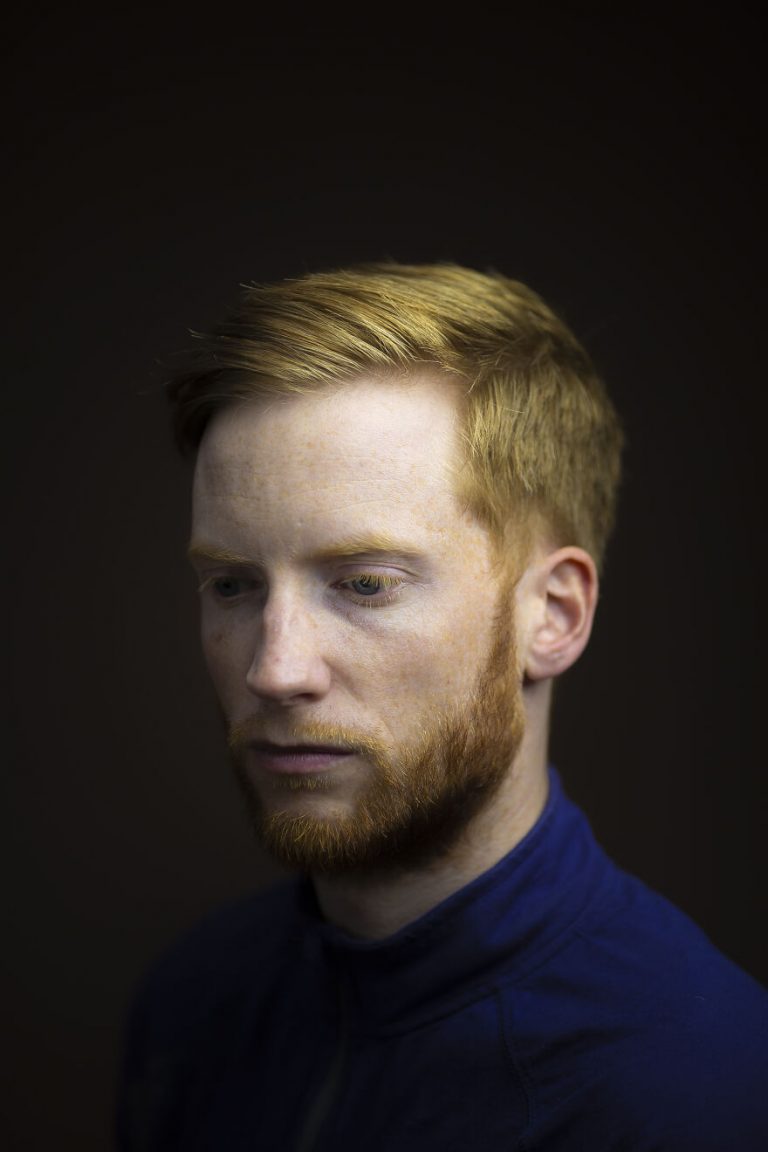 Scottish Photographer Has Been Photographing Ginger People Around The ...