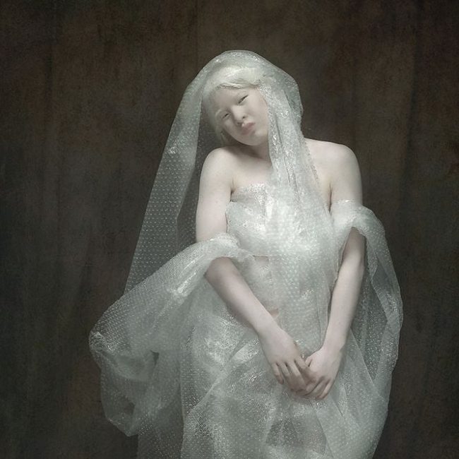 Abandoned As A Baby Due To Albinism, Xueli Grew Up To Become A Vogue Model » Design You Trust ...