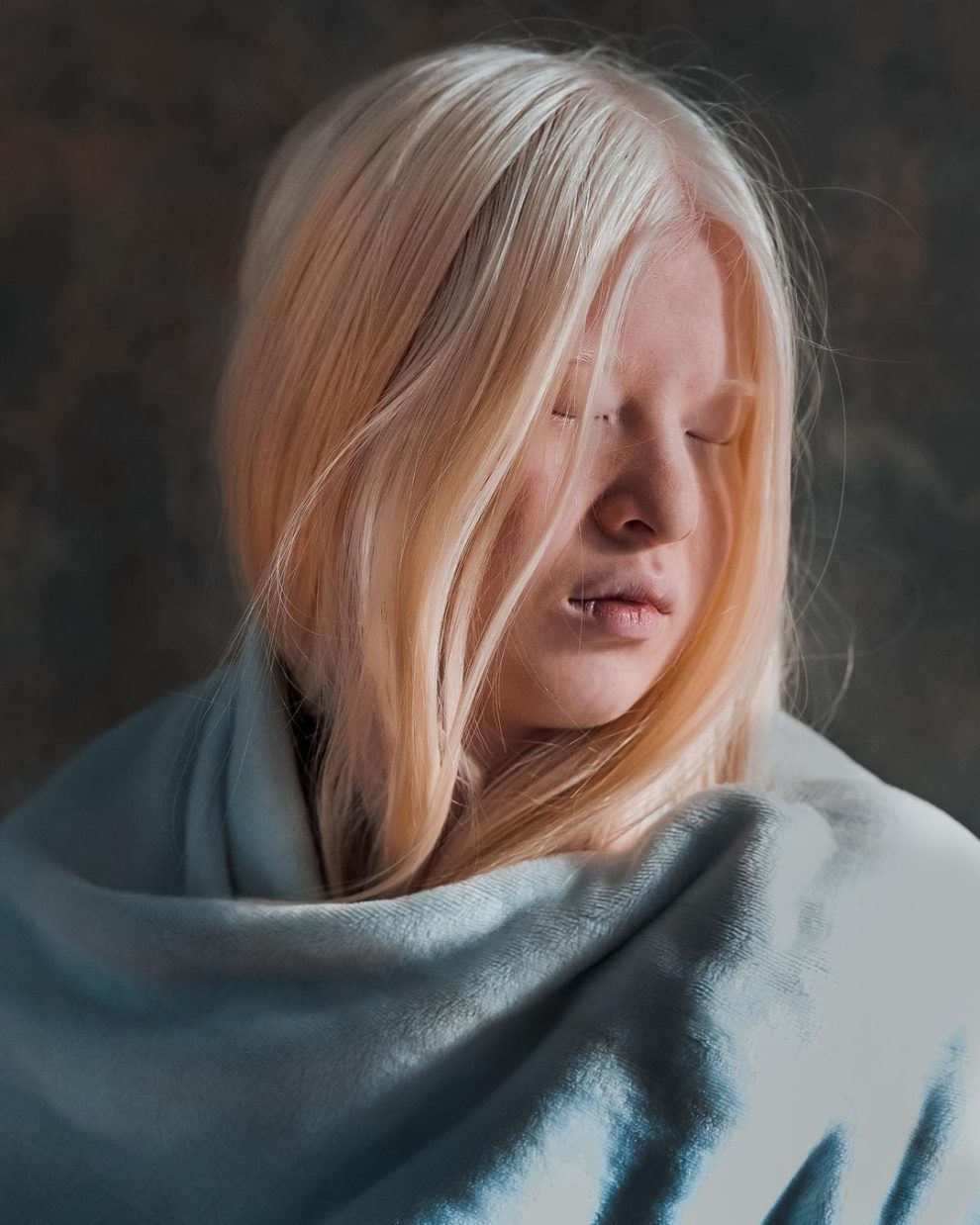 Abandoned As A Baby Due To Albinism, Xueli Grew Up To Become A Vogue Model » Design You Trust ...