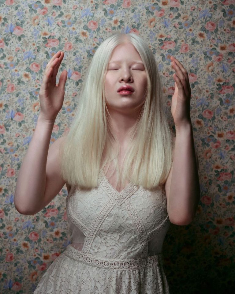 Abandoned As A Baby Due To Albinism, Xueli Grew Up To Become A Vogue Model » Design You Trust ...