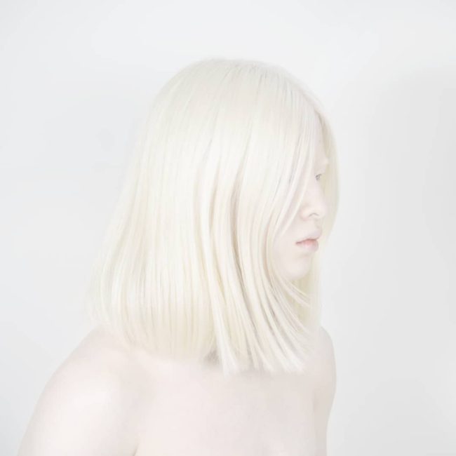 Abandoned As A Baby Due To Albinism, Xueli Grew Up To Become A Vogue ...