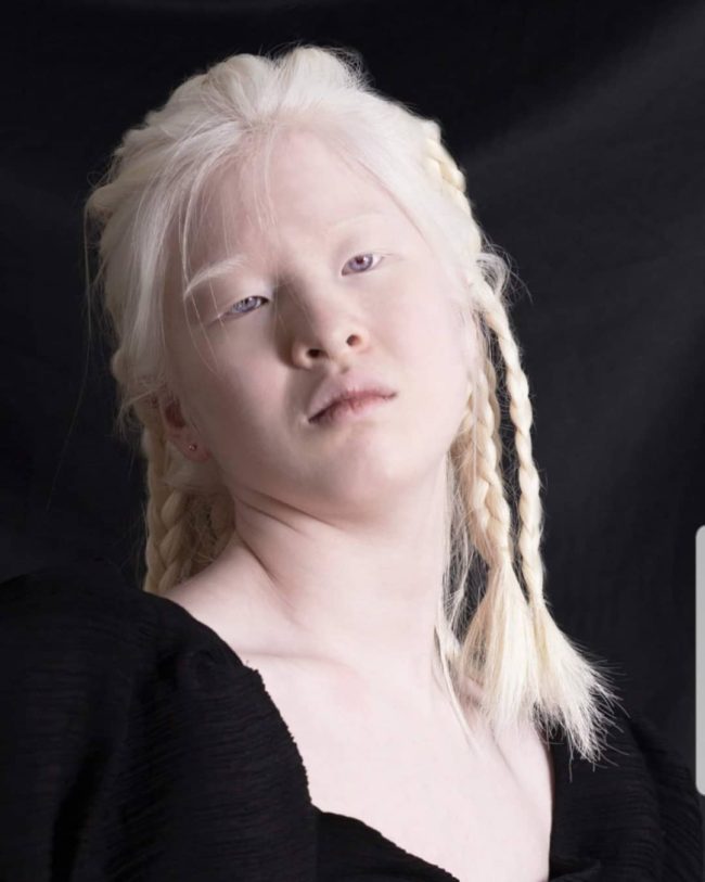 Abandoned As A Baby Due To Albinism, Xueli Grew Up To Become A Vogue Model » Design You Trust ...