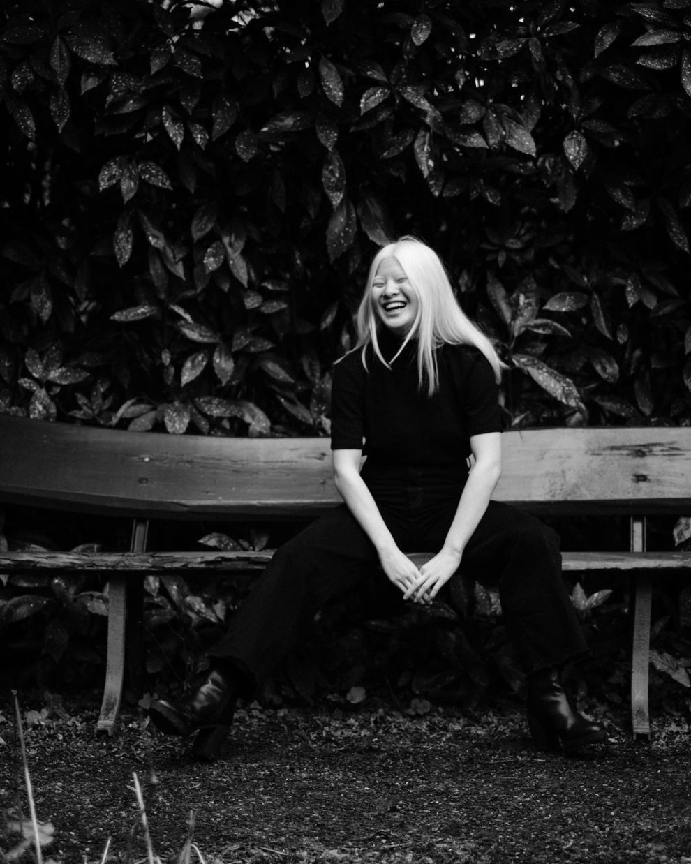 Abandoned As A Baby Due To Albinism, Xueli Grew Up To Become A Vogue ...