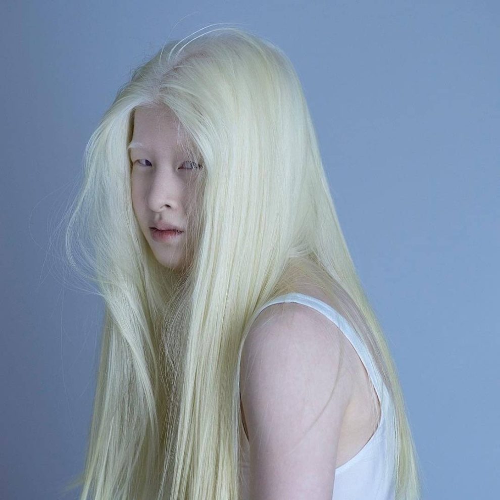 Abandoned As A Baby Due To Albinism, Xueli Grew Up To Become A Vogue Model » Design You Trust ...