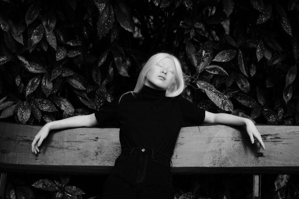 Abandoned As A Baby Due To Albinism, Xueli Grew Up To Become A Vogue ...