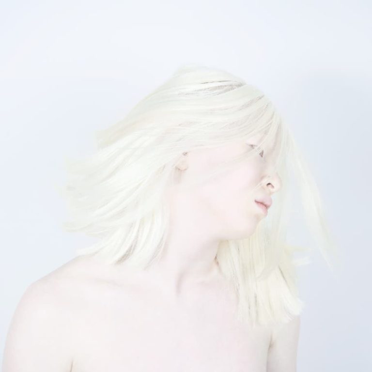 Abandoned As A Baby Due To Albinism, Xueli Grew Up To Become A Vogue ...