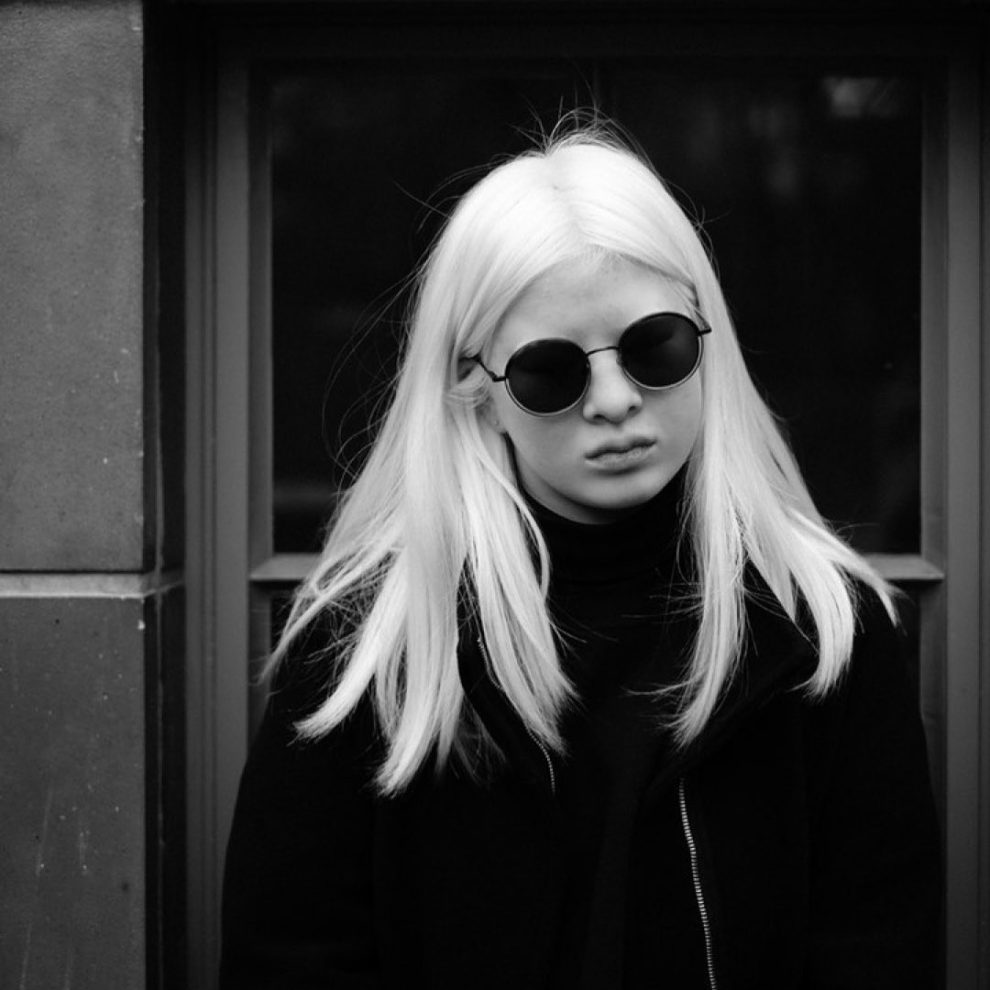 Abandoned As A Baby Due To Albinism, Xueli Grew Up To Become A Vogue ...