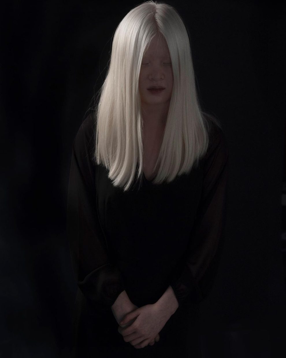 Abandoned As A Baby Due To Albinism, Xueli Grew Up To Become A Vogue ...