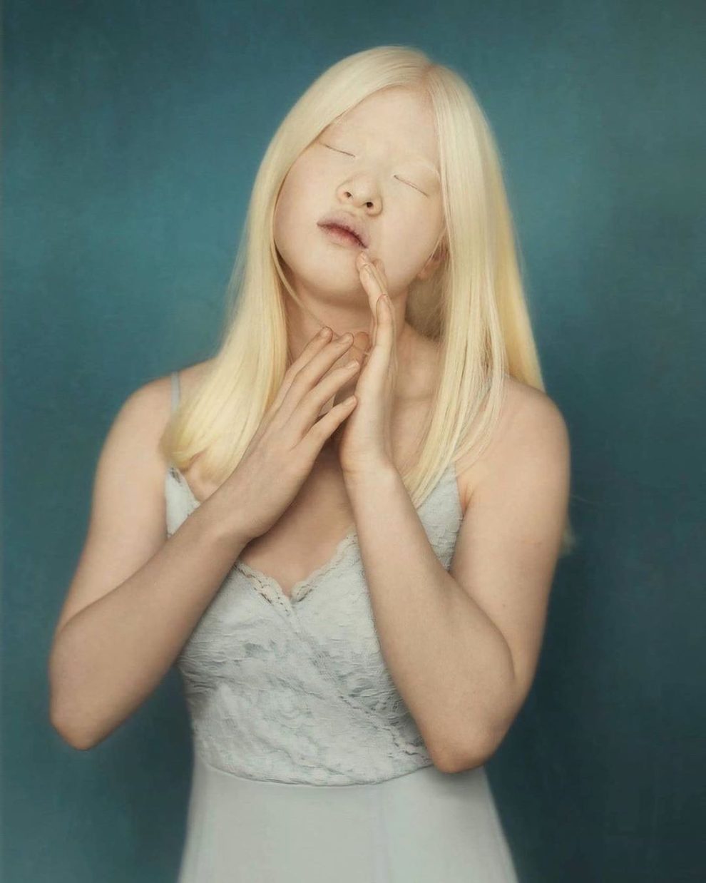 Abandoned As A Baby Due To Albinism, Xueli Grew Up To Become A Vogue Model » Design You Trust ...